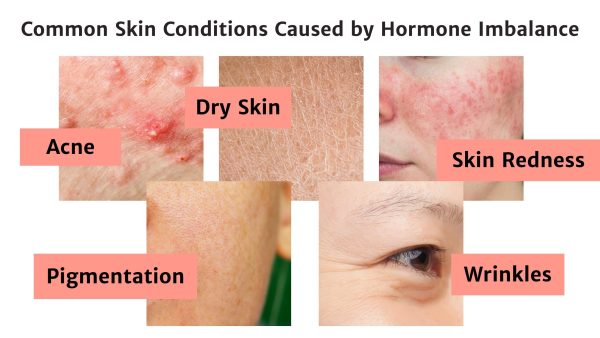 Sheep Placenta: Side Effects and Misconceptions - CellLabs